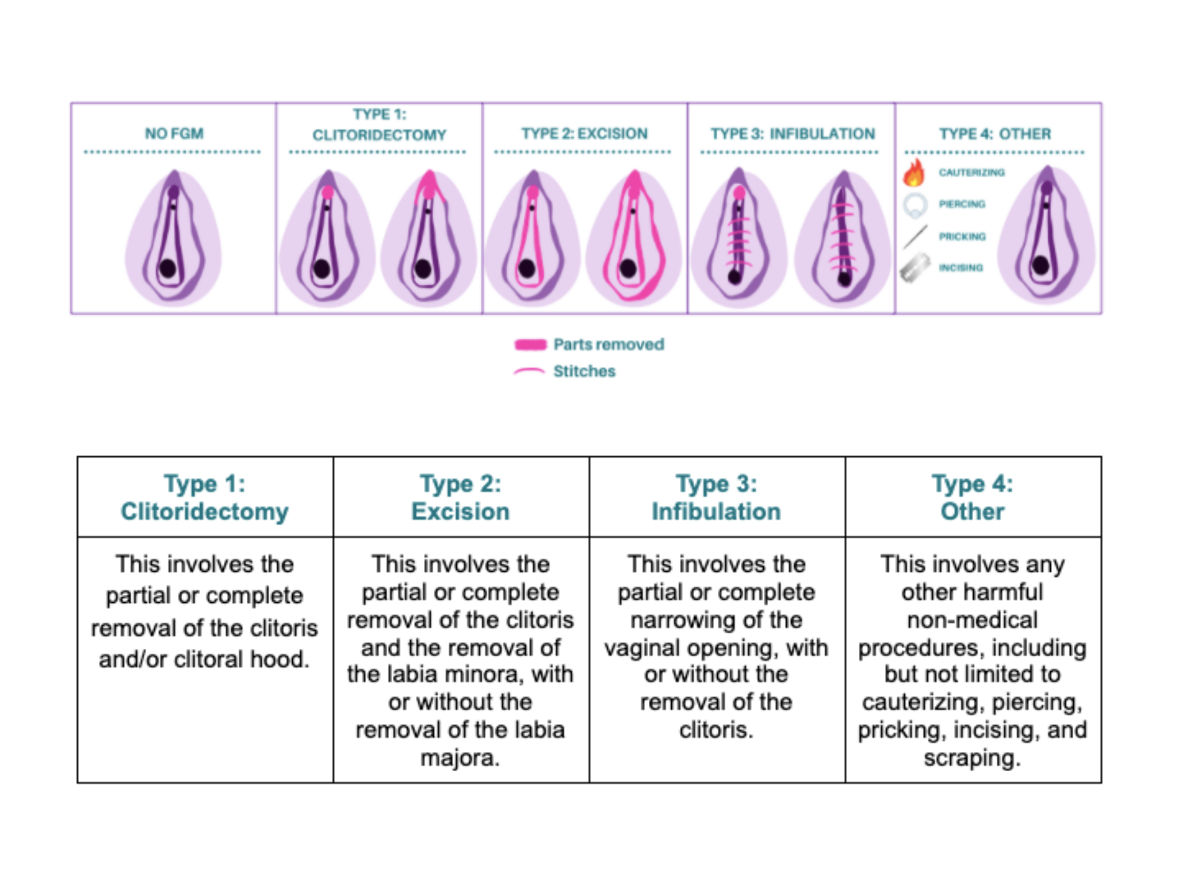 Types Of Circumcision Cuts